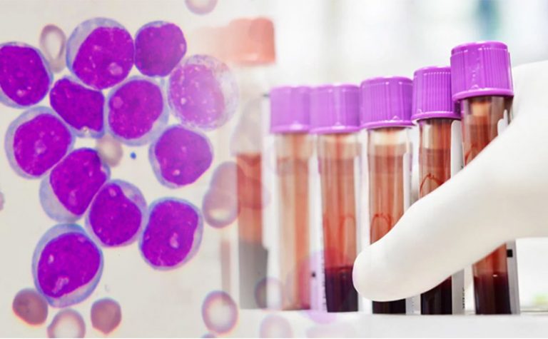 Resultados inéditos para los adultos con la leucemia más frecuente ...